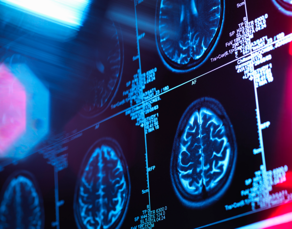 Brain Health - Viavi